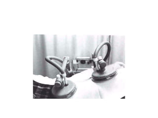 SWD (Short wave diathermy)- Physiotherapy.ppt