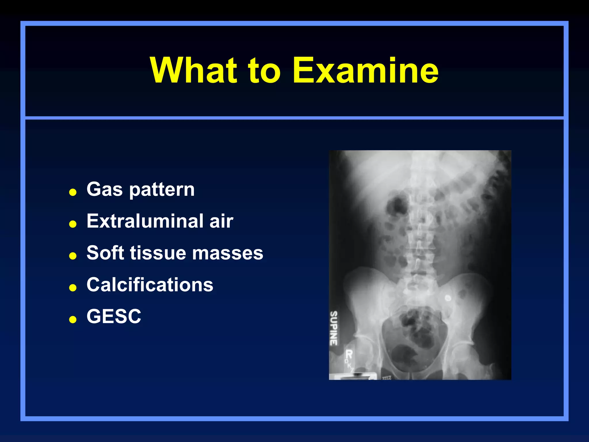 Abdominal cavity organs radiological examination | PPT