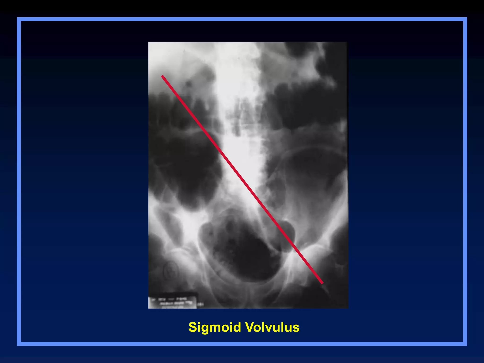 Abdominal cavity organs radiological examination | PPT