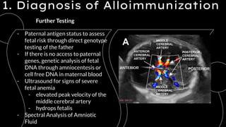 Topic 19: Alloimmunization in Pregnancy.pdf