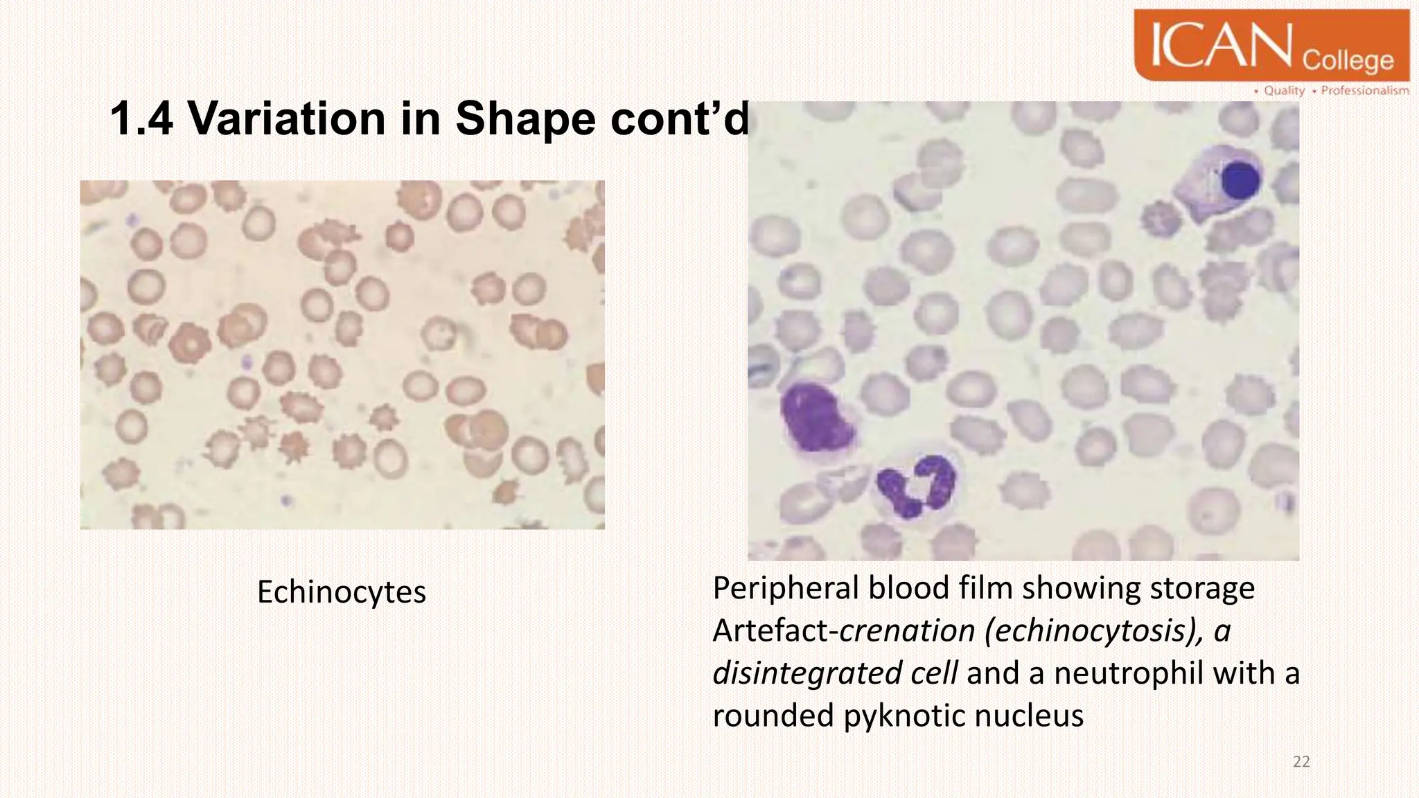 TOPIC 1 HEMATOLOGY RED CELL MORPHOLOGY STUDY.pptx