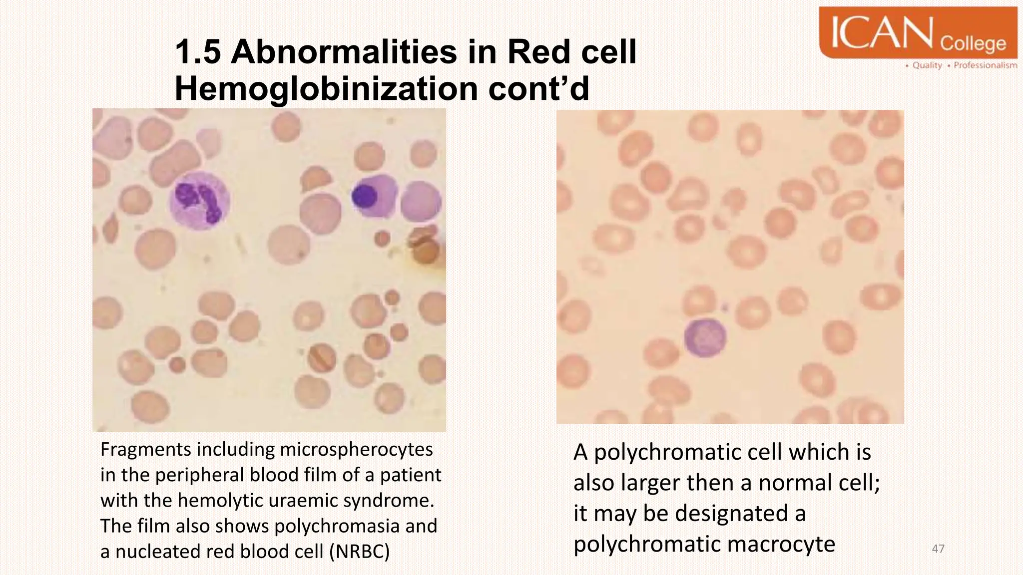TOPIC 1 HEMATOLOGY RED CELL MORPHOLOGY STUDY pptx TOPIC 1 HEMATOLOGY RED CELL MORPHOLOGY STUDY pptx
