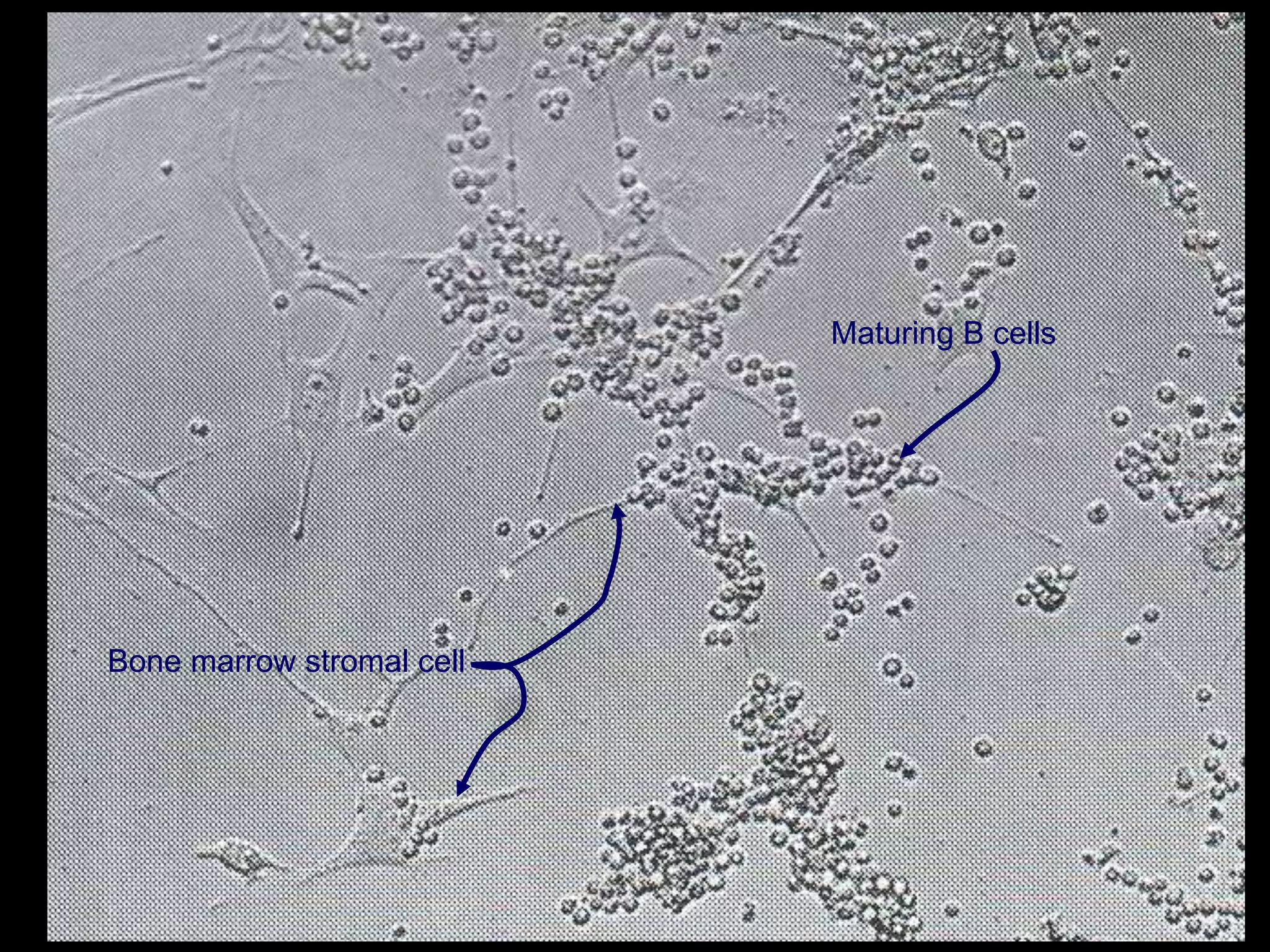 Topic 3 B cell development.ppt | Endocrine and Metabolic Diseases ...
