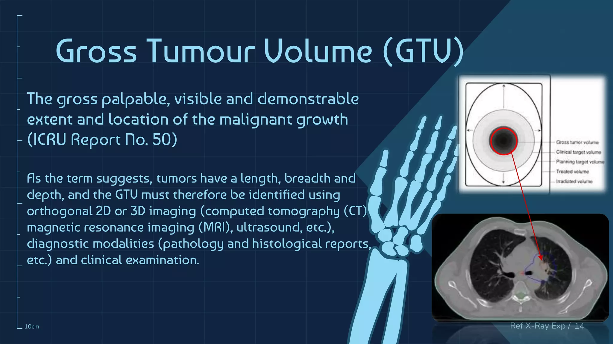BASIC RADIOBIOLOGY FOR RADIOTHERAPY | PPTX
