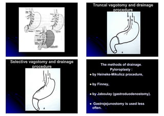 Peptic ulcer (Lect-ms).pdf about the disease of GIT | PDF