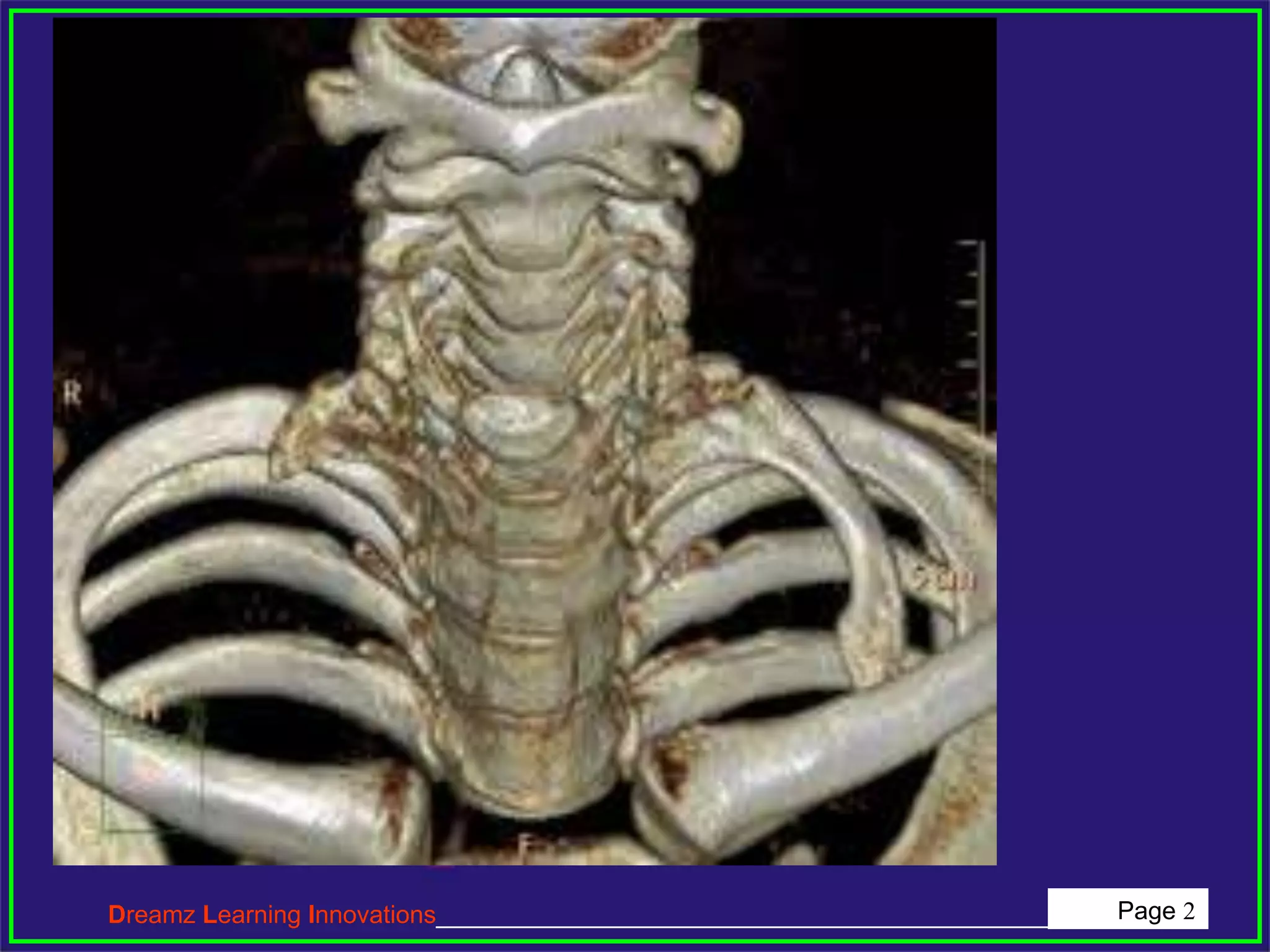 Topic 60 CERVICAL RIB.ppt