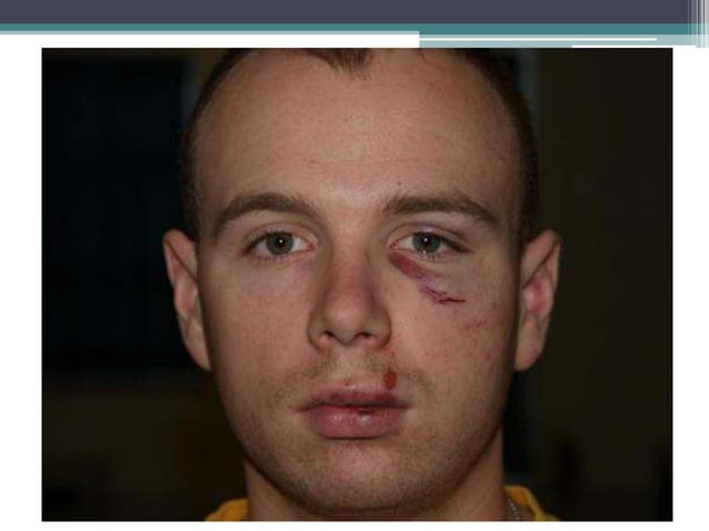 Traumatology of the maxillofacial region. Soft tissue injuries of the ...