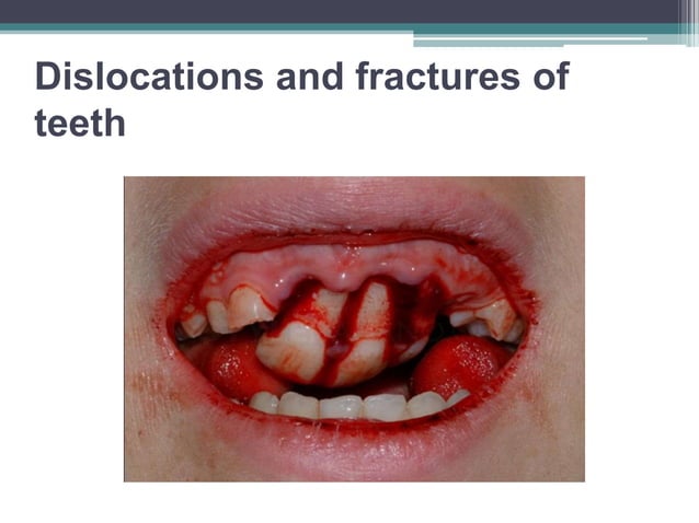 Traumatology of the maxillofacial region. Soft tissue injuries of the ...