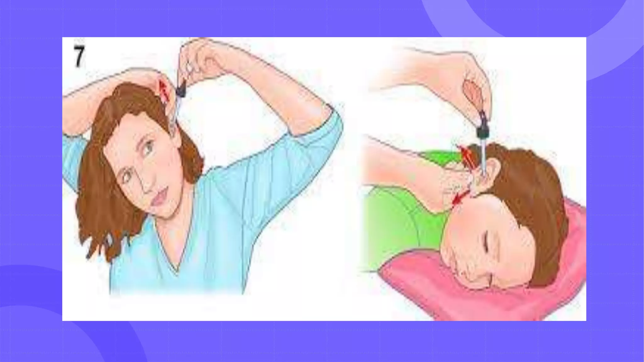 Topical administration | PPTX