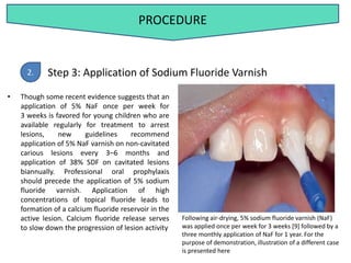 TOPICAL APPLICATION FLUORIDE.pptx