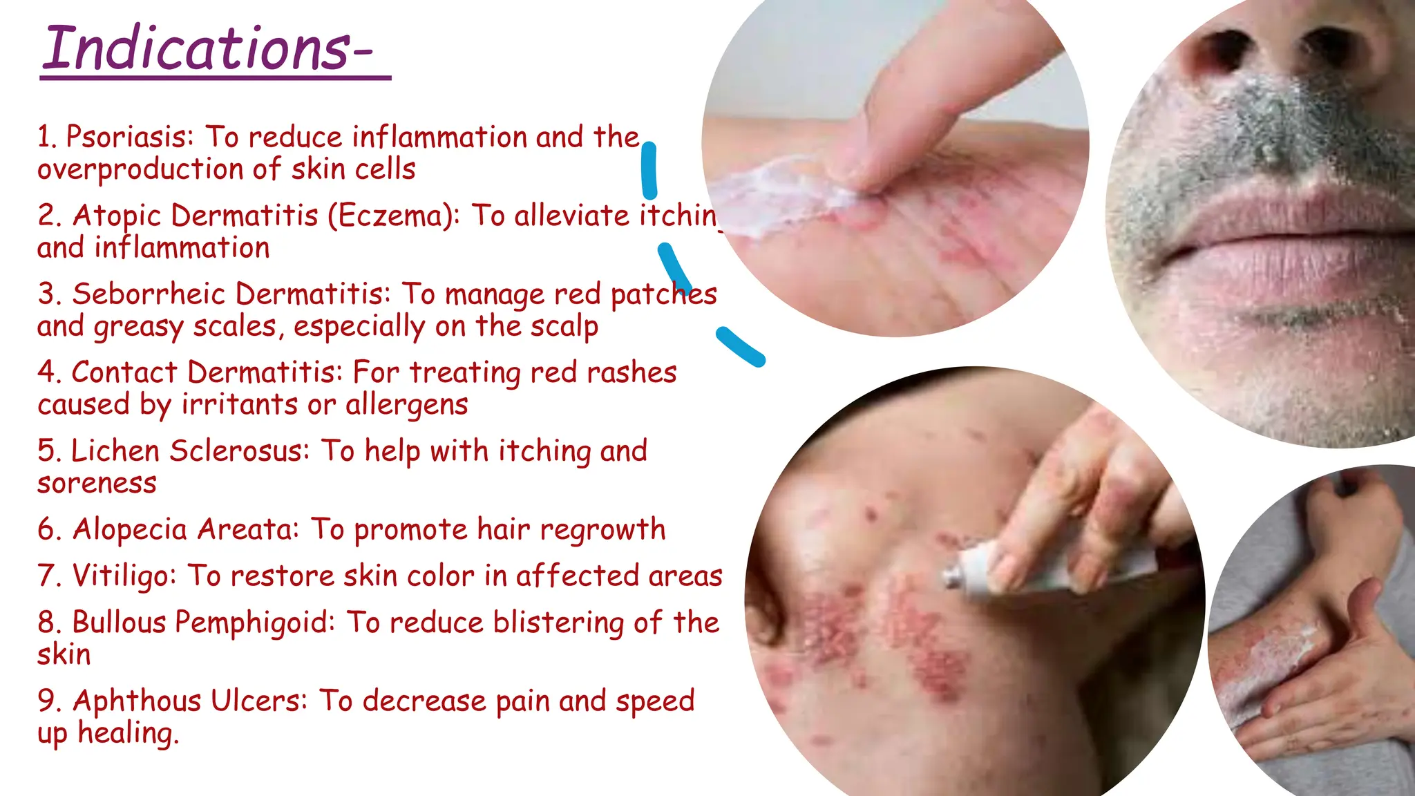 Topical corticosteroids and their uses , applications ...