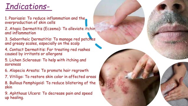 Topical corticosteroids and their uses , applications ...