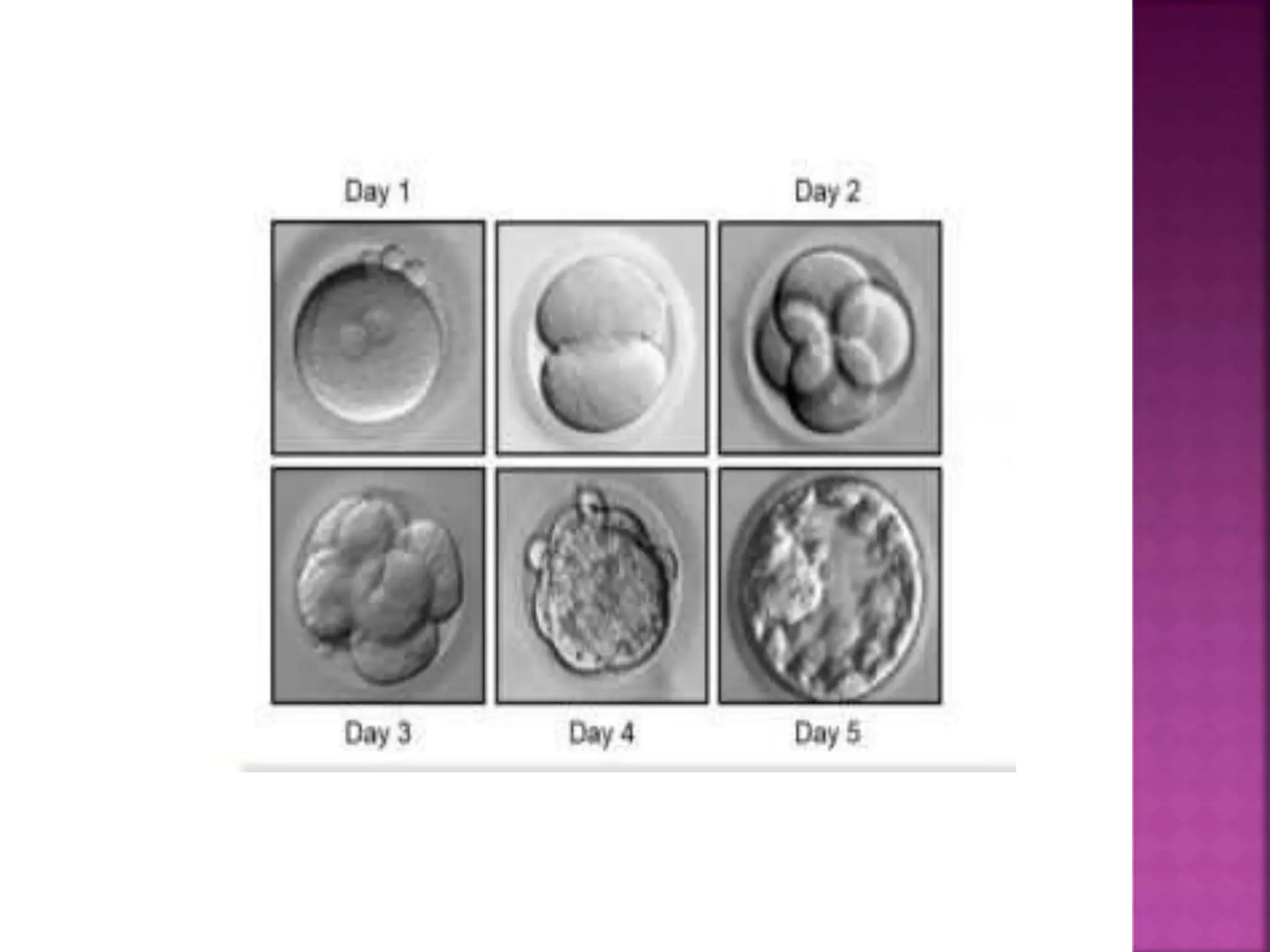 ARTIFICIAL REPRODUCTIVE TECHNIQUE | PPTX