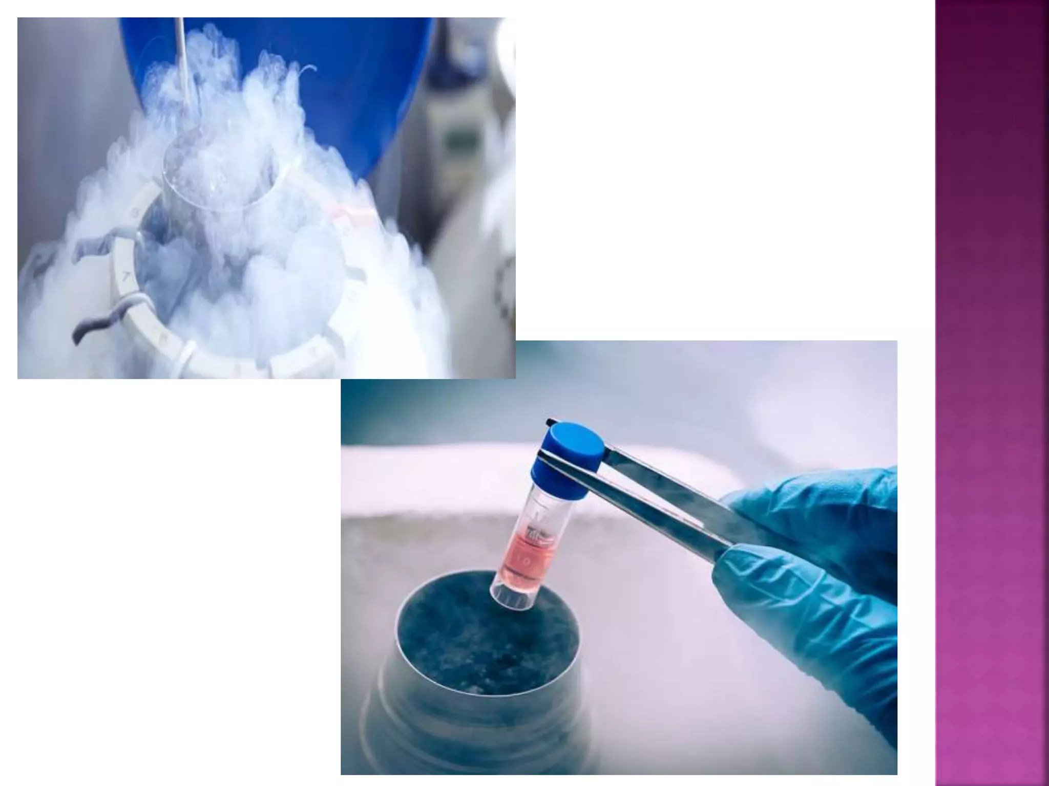 ARTIFICIAL REPRODUCTIVE TECHNIQUE | PPTX