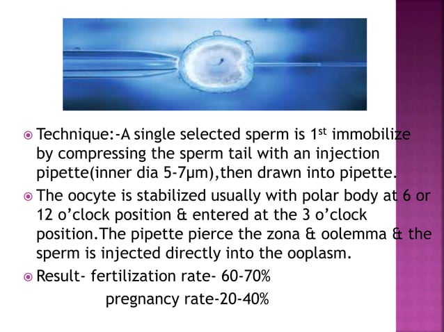 ARTIFICIAL REPRODUCTIVE TECHNIQUE | PPTX | Pregnancy | Reproductive Health