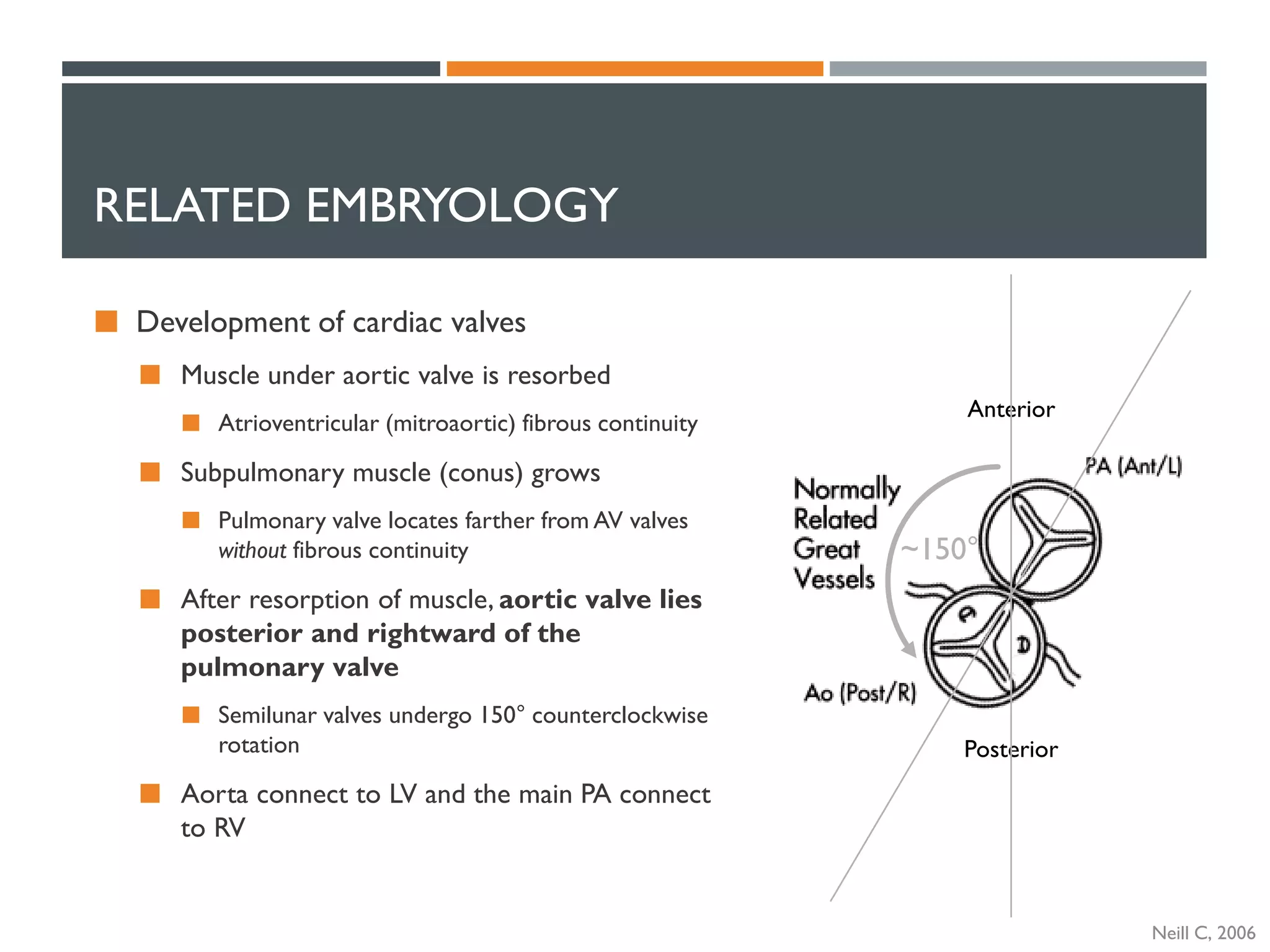 Segmental approach to Congenital Heart Disease | PDF