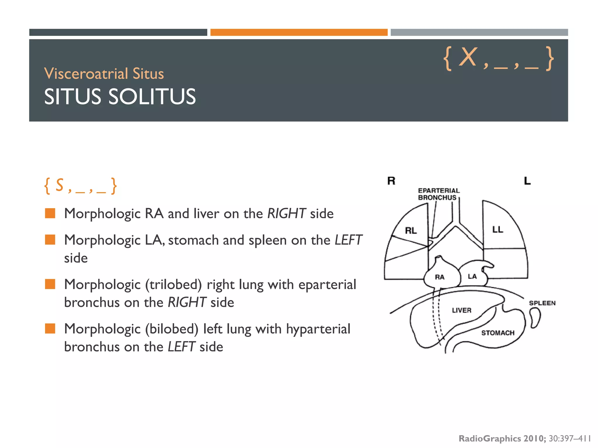 Segmental approach to Congenital Heart Disease | PDF