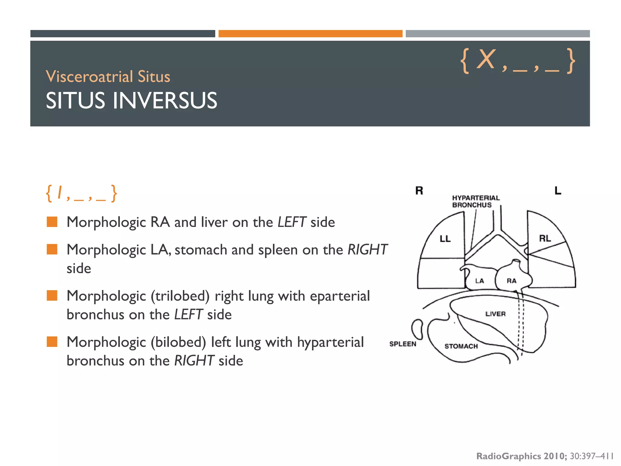 Segmental approach to Congenital Heart Disease | PDF