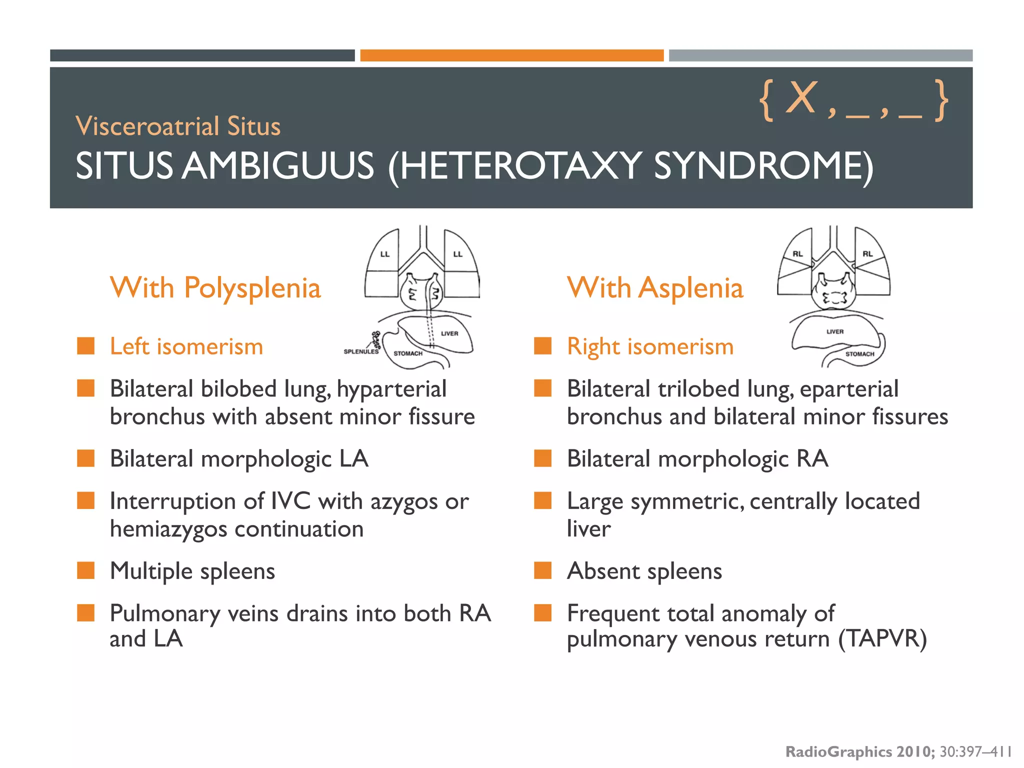 Segmental approach to Congenital Heart Disease | PDF