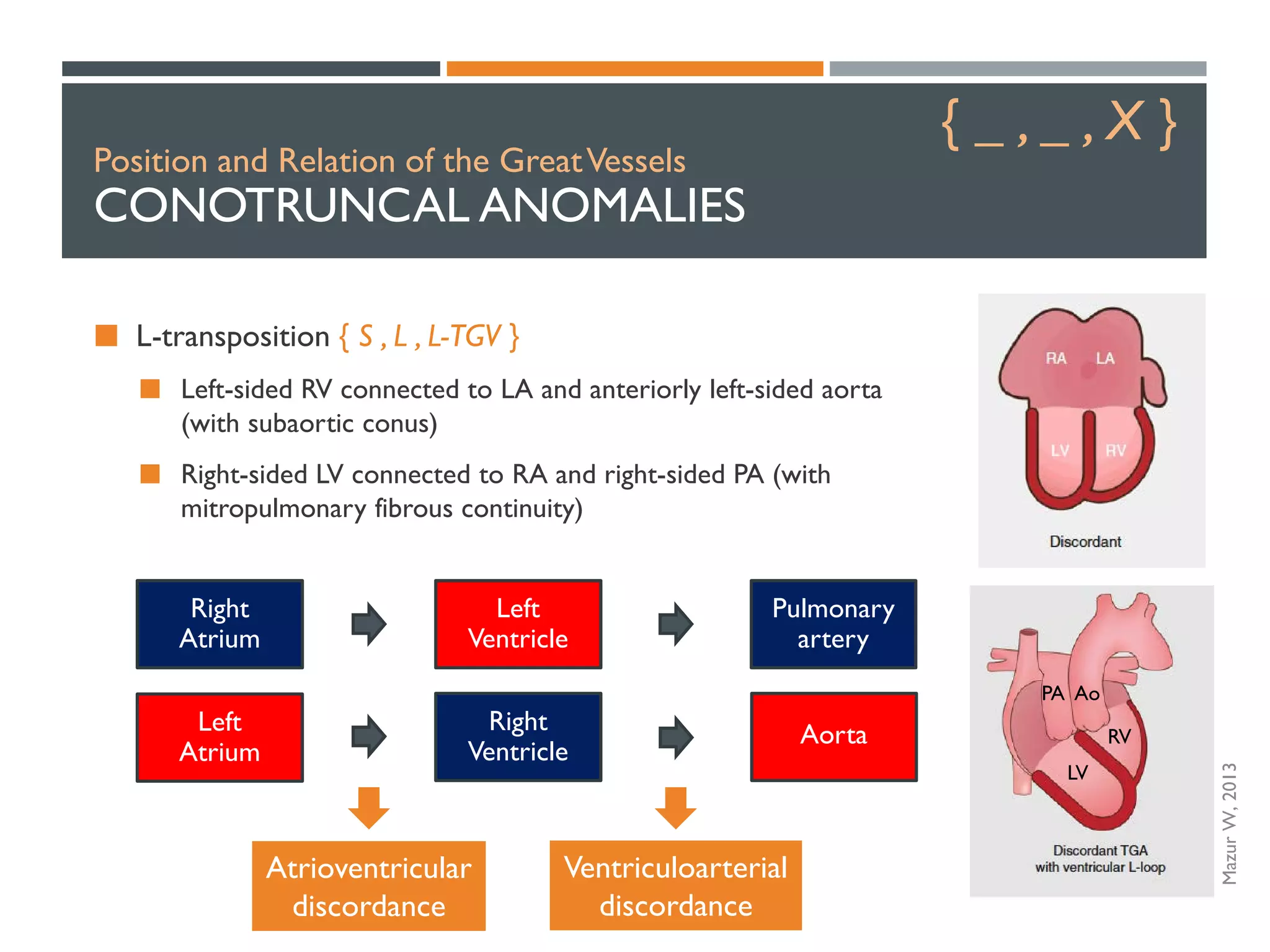 Segmental approach to Congenital Heart Disease | PDF