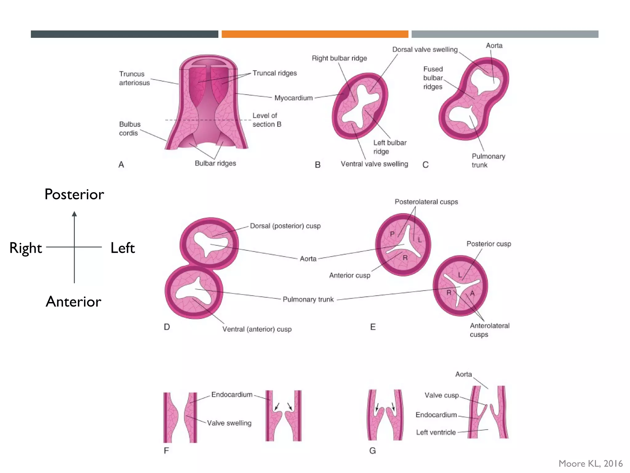 Segmental approach to Congenital Heart Disease | PDF