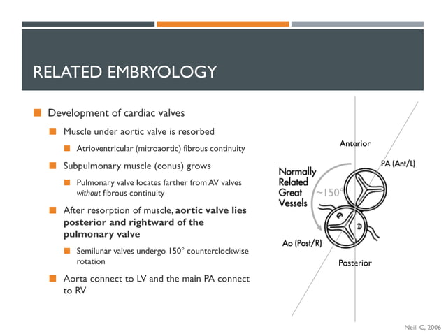 Segmental approach to Congenital Heart Disease | PDF | Heart and ...