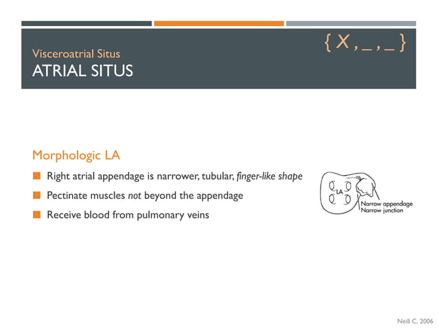 Segmental approach to Congenital Heart Disease | PDF | Heart and ...