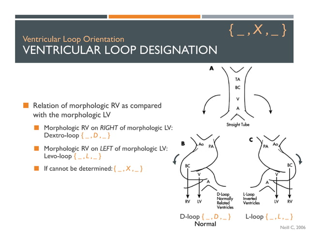 Segmental approach to Congenital Heart Disease | PDF | Heart and ...