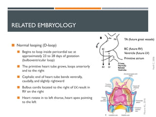 Segmental approach to Congenital Heart Disease | PDF