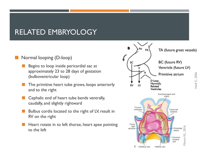 Segmental approach to Congenital Heart Disease | PDF | Heart and ...
