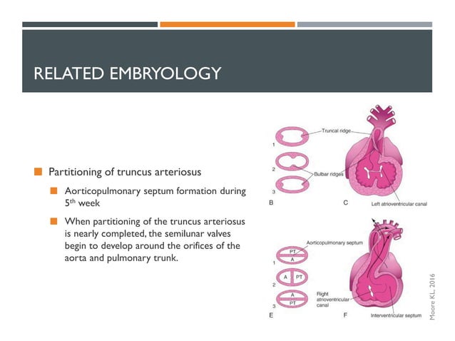 Segmental approach to Congenital Heart Disease | PDF | Heart and ...
