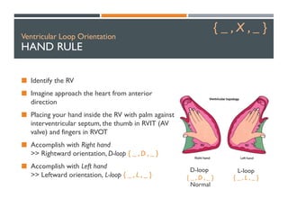 Segmental approach to Congenital Heart Disease | PPT