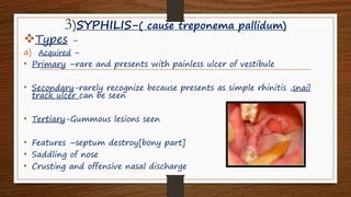 TOPIC – GRANULOMATOUS DISEASES OF NOSE | PPTX
