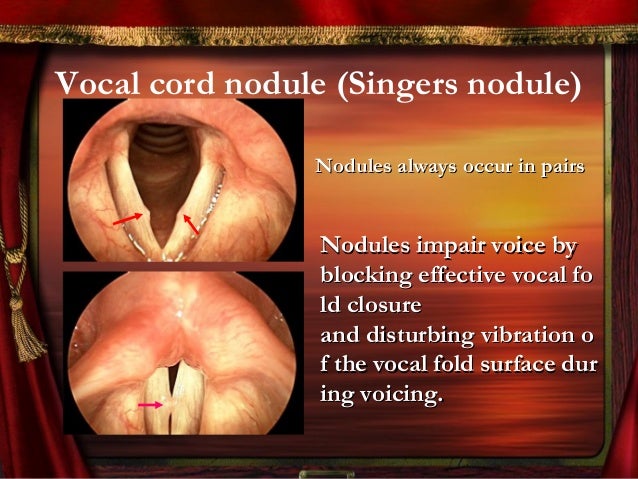 Topic-Hoarseness Part1