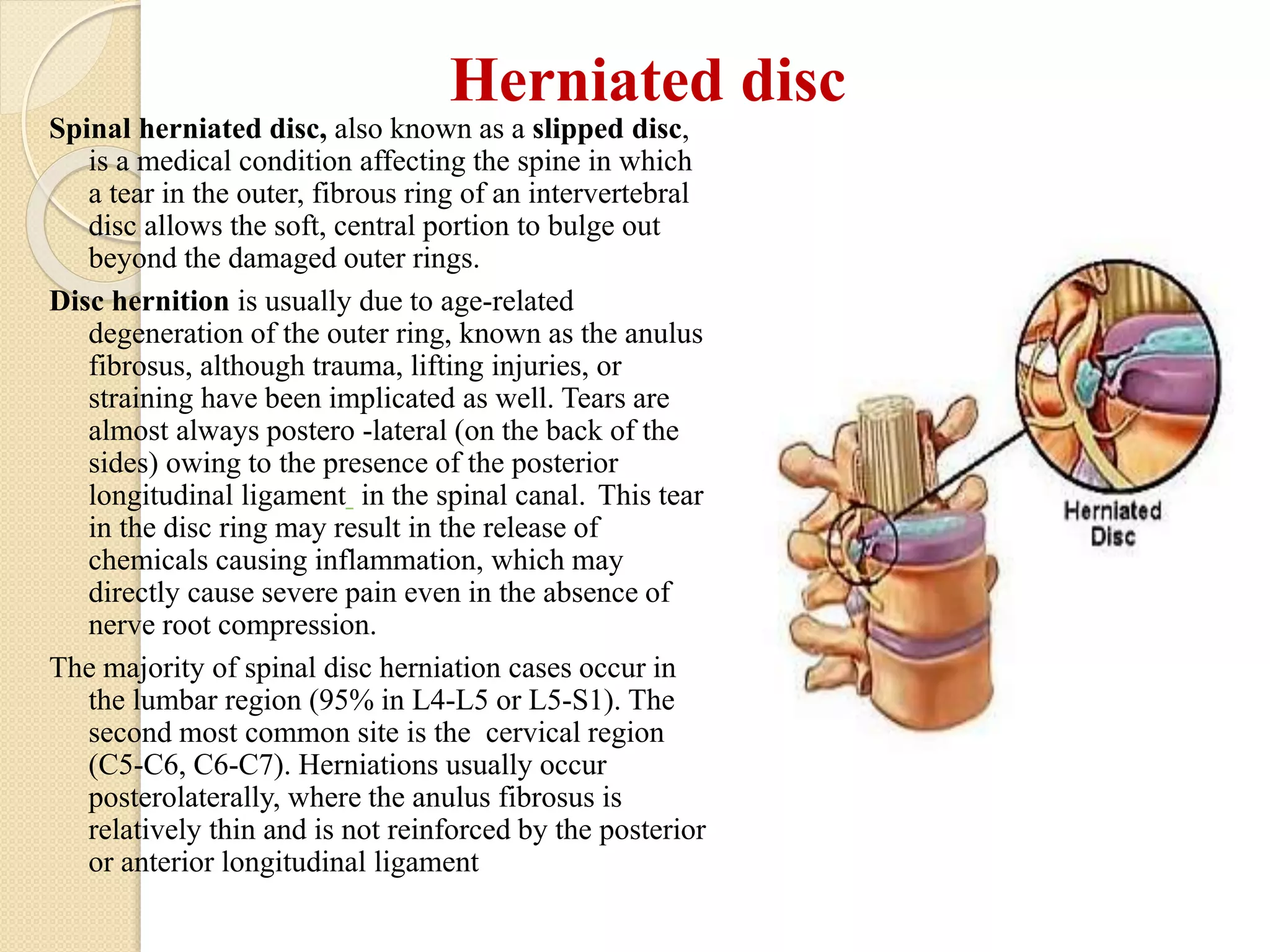 Surgery & anatomy of vertebral column and spinal nerves | PPTX