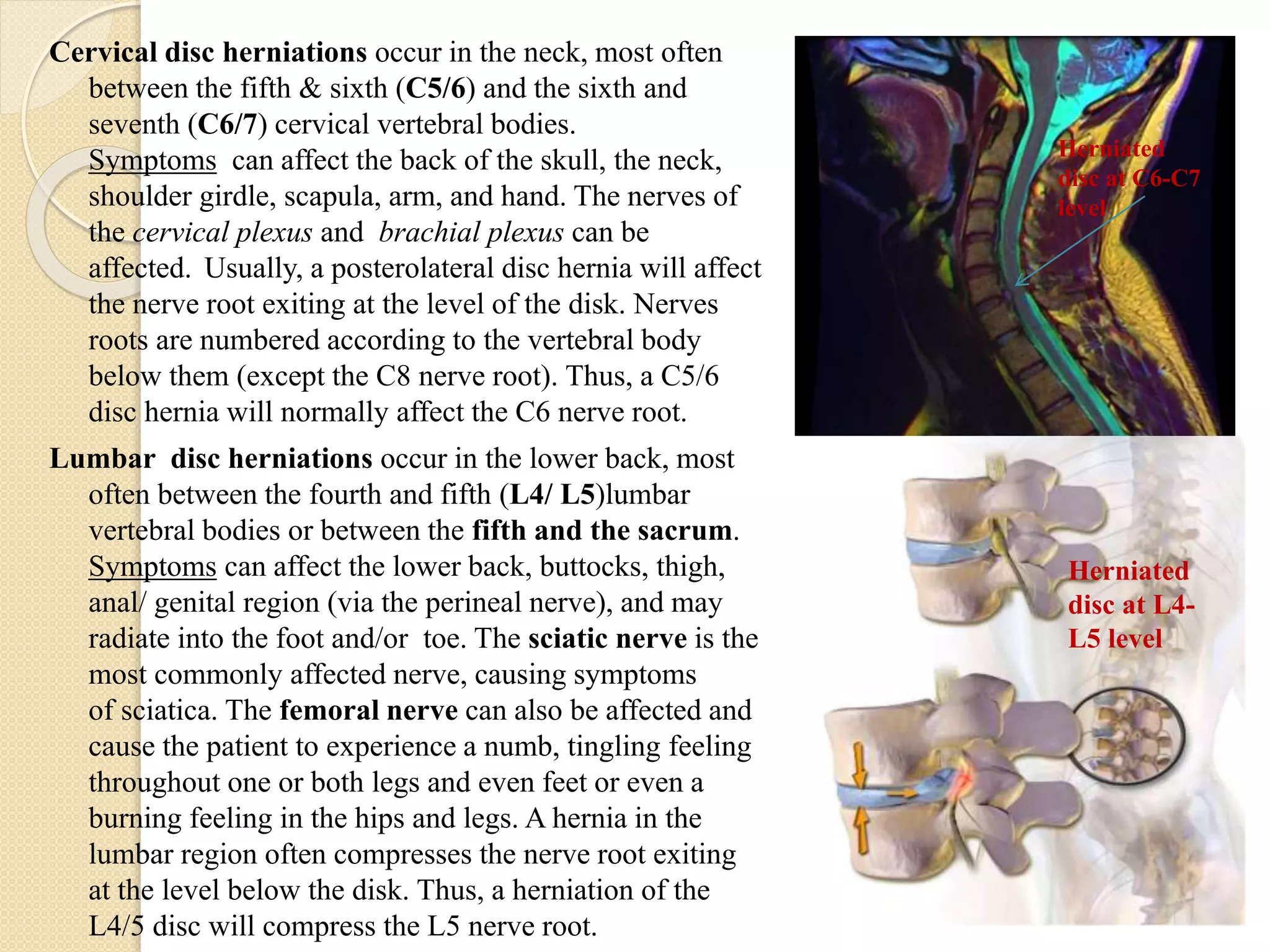 Surgery & anatomy of vertebral column and spinal nerves | PPTX