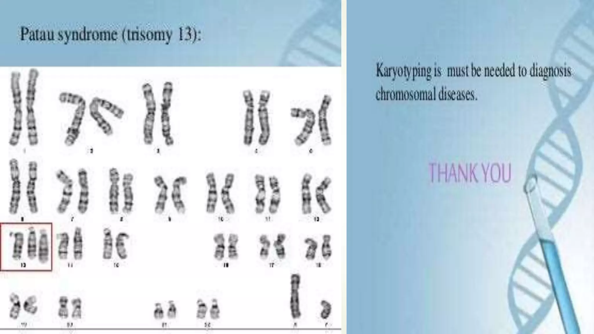 Topic karyotype | PPT
