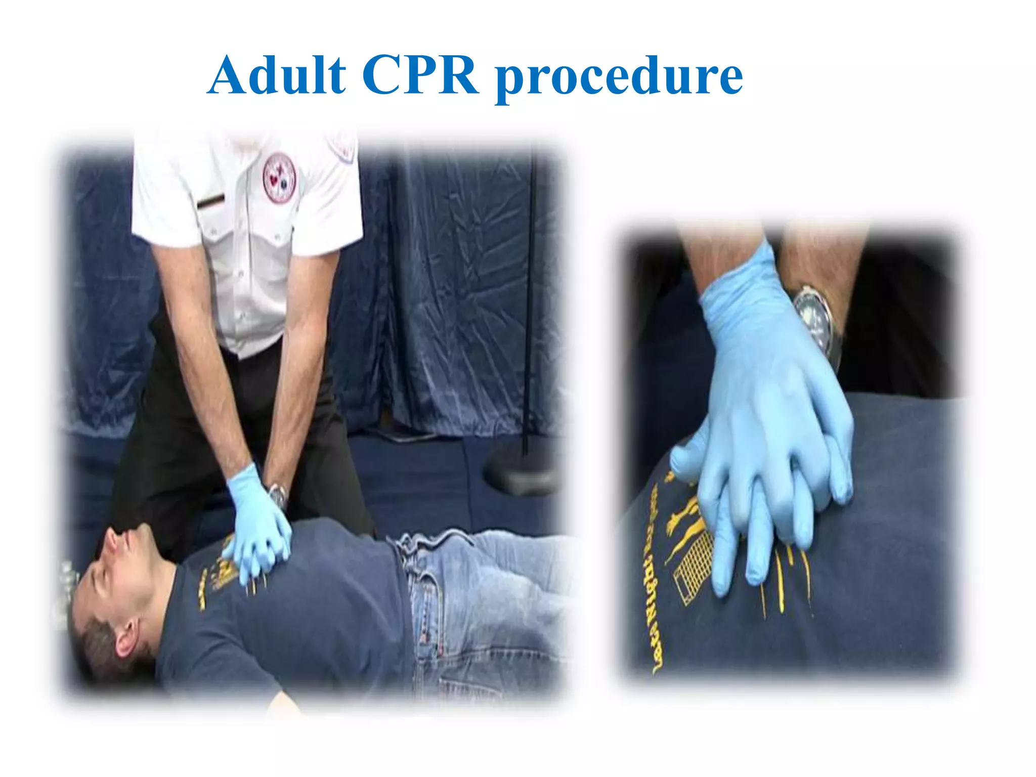 About CPR and CPR procedure | PPTX
