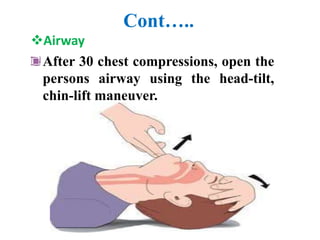 About CPR and CPR procedure | PPTX