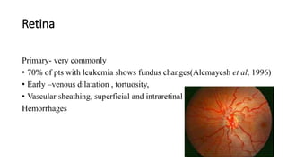 OPHTHALMIC MANIFESTATION OF LEUKEMIA.pptx
