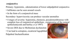 OPHTHALMIC MANIFESTATION OF LEUKEMIA.pptx