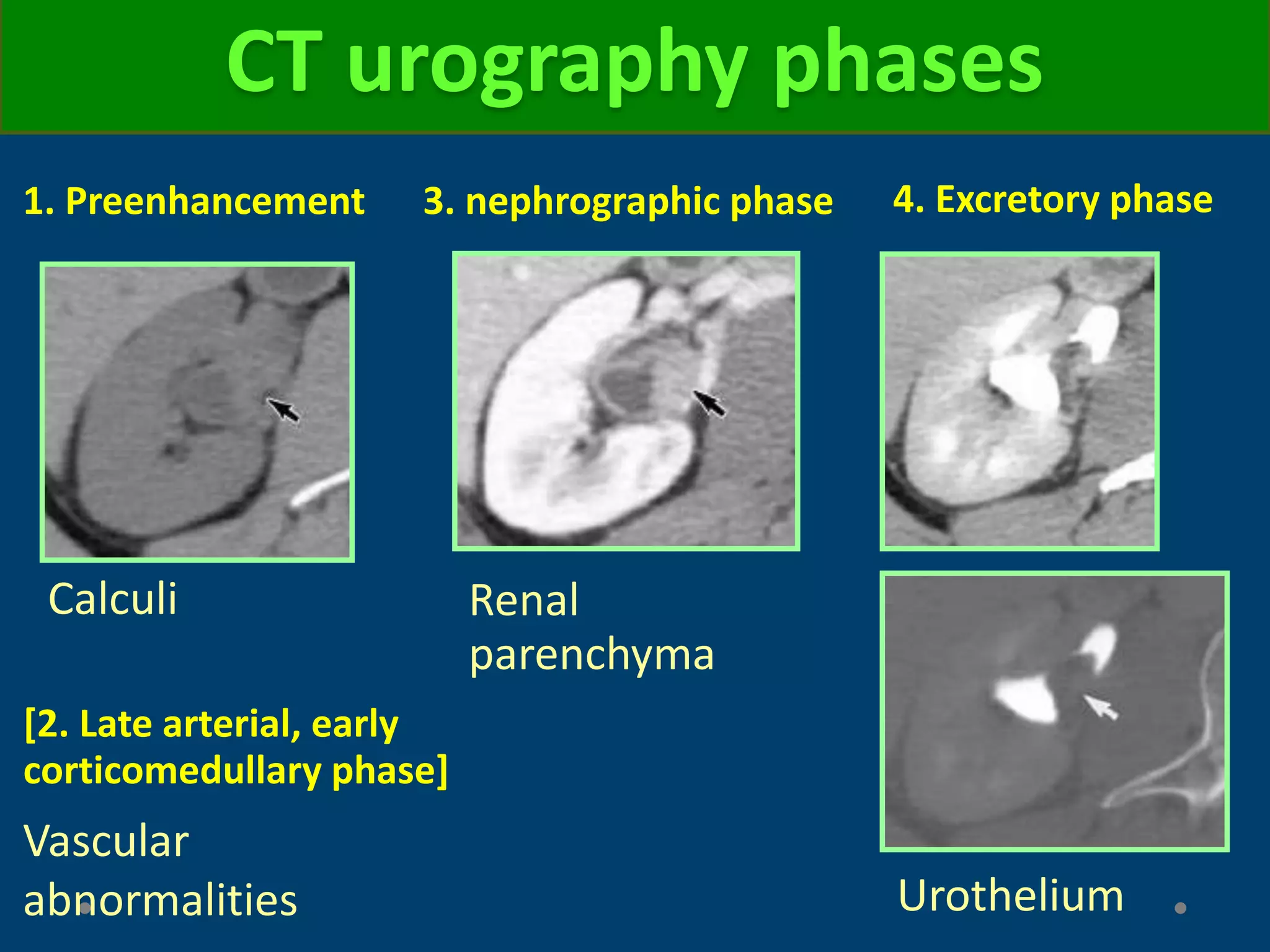 Renal mass | PPTX