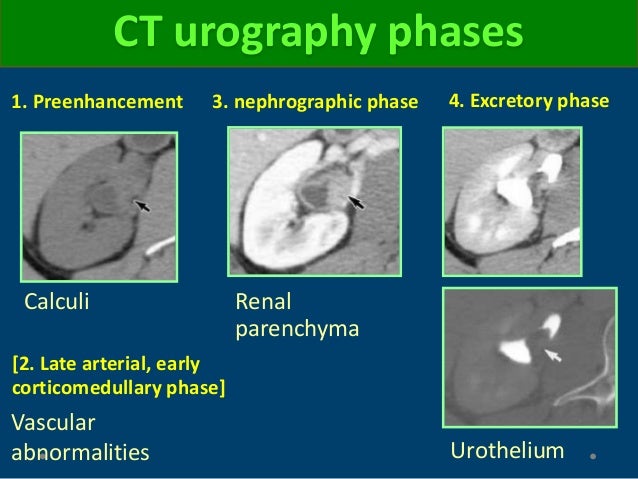 Renal mass