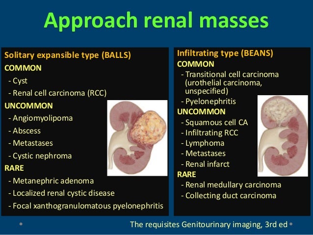 Renal Mass