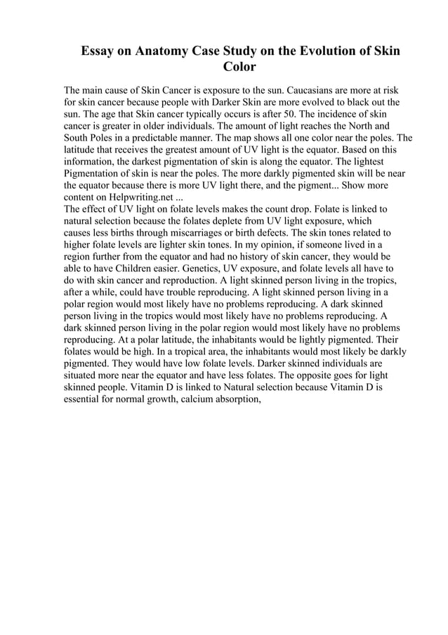 Topics For Discursive Essays. How To Write Discursive Essay? Structure ...