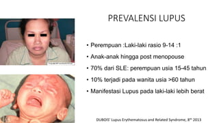 TOPIK 1 - PENDEKATAN DIAGNOSIS DAN TATA LAKSANA SLE.pdf