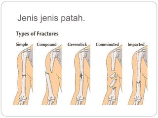 Topik 4 sains sukan | PPTX
