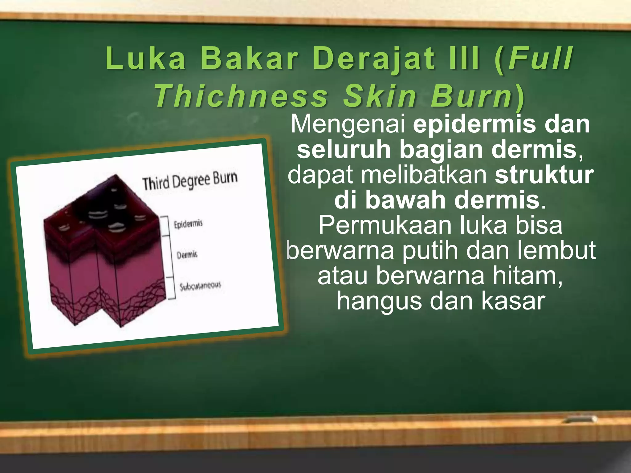 Topik 7 Penanganan Luka Bakar.pptx