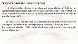 Topiramate presentation slideshow ppt.pptx
