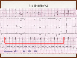 ECG interpretation moonlighting medicine | PDF